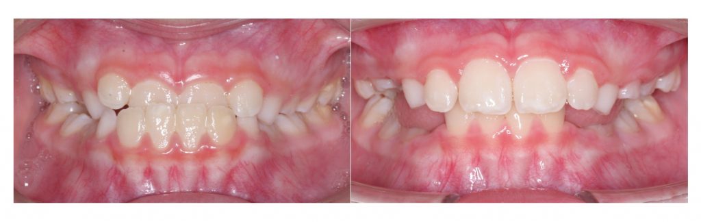 7 and UP Club - Miller Orthodontics